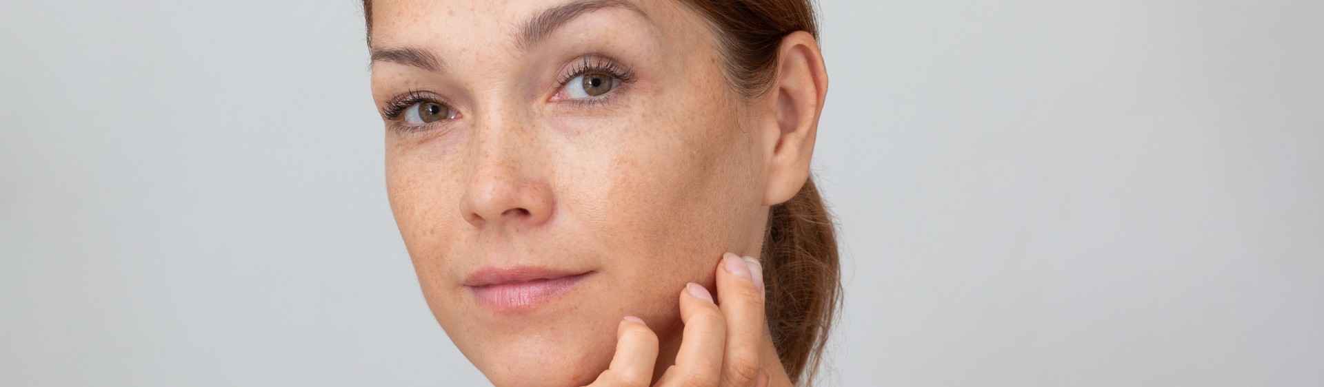 What Are the Most Effective Treatments for Age Spots?